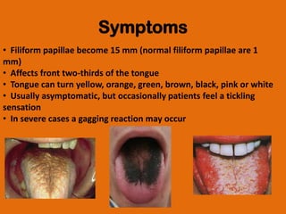 Lingua villosa | PPTX