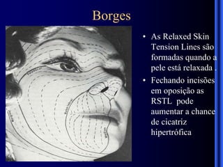 Linhas de Força de Langers.pptx