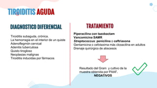 Tiroiditis tiroiditis tiroiditis tiroiditis | PPTX