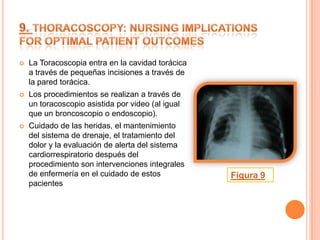 Toracoscopia | PPTX