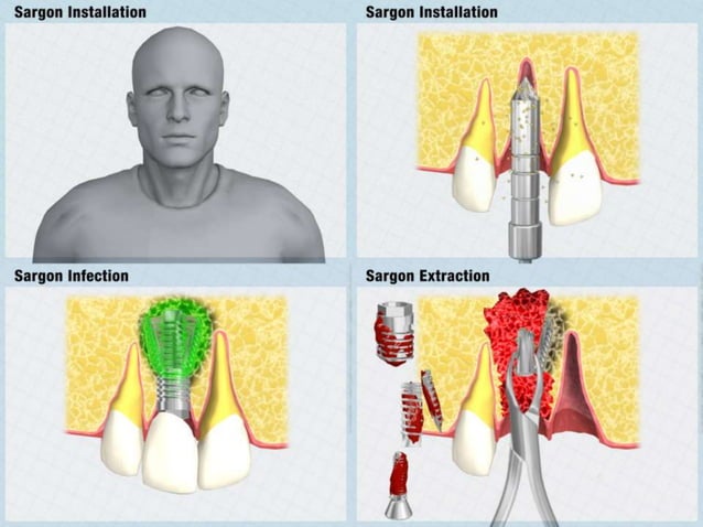 Litigation Graphics Samples | PPT