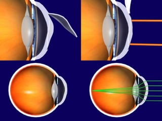 Litigation Graphics Samples | PPT
