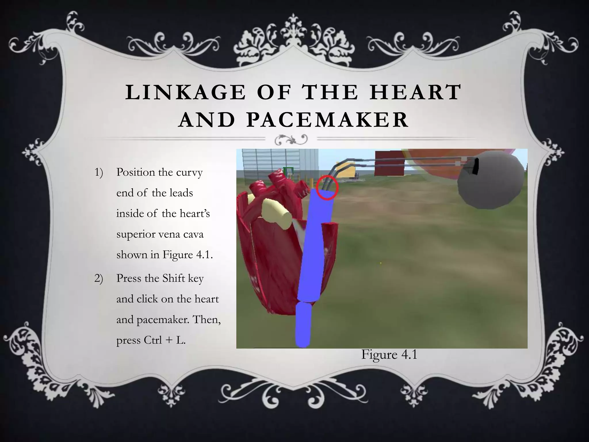 Link heart pacemaker | PPTX