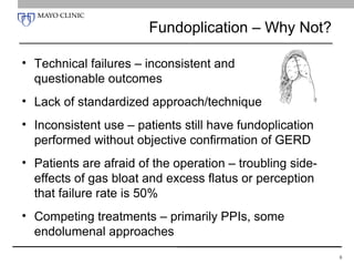 Advances in Managing GERD - LINX | PPT