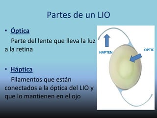 Lentes Intraoculares | PPTX