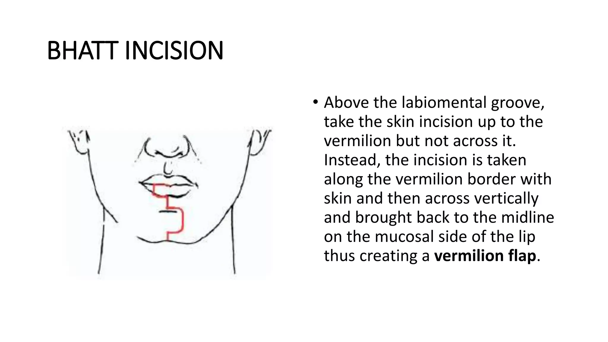 Lip splitting incisions | PPT
