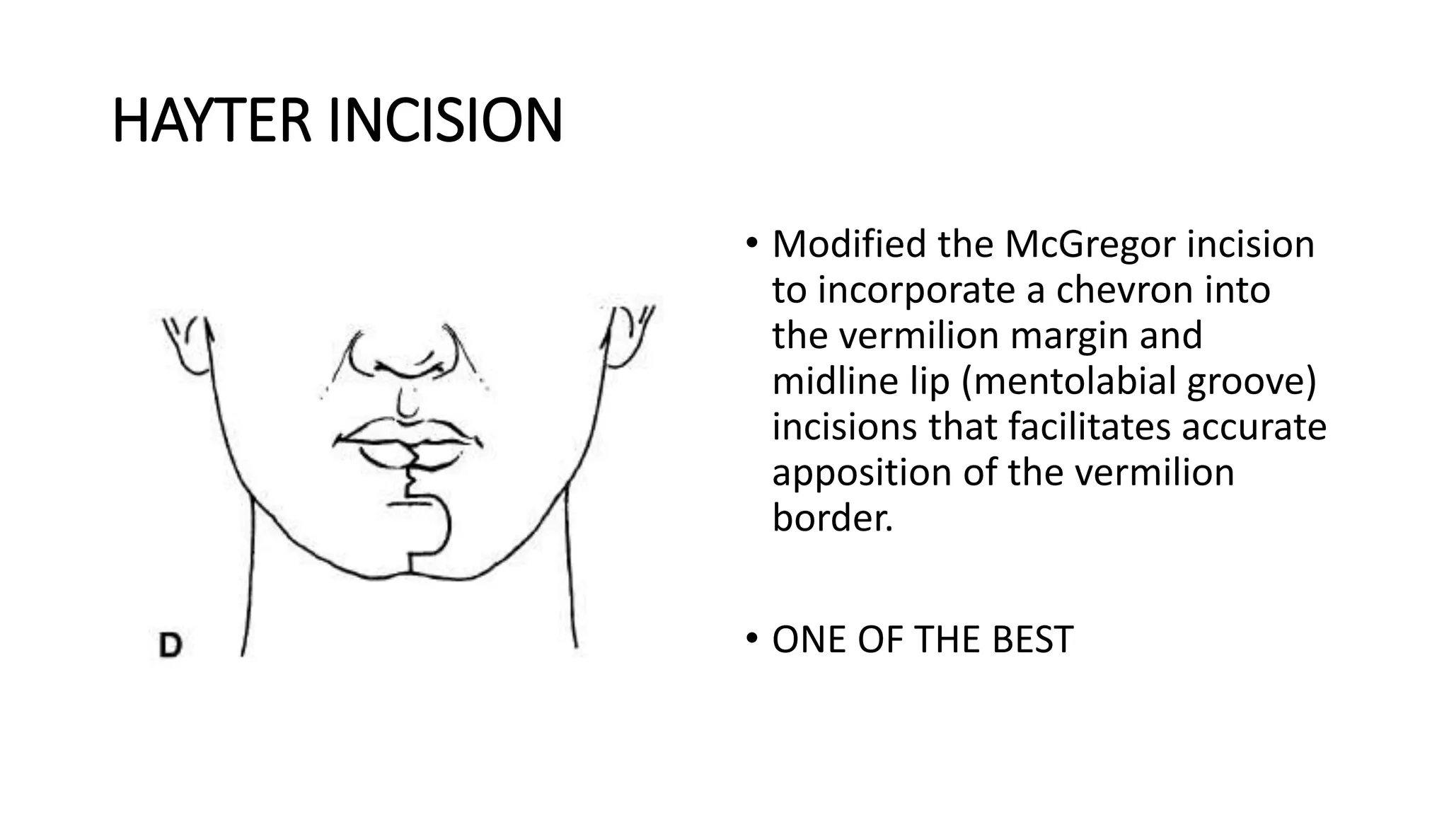 Lip splitting incisions | PPT