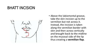 Lip splitting incisions | PPT