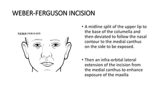 Lip splitting incisions | PPT