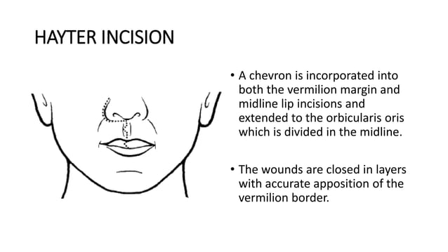 Lip splitting incisions | PPT | Death, Injury, or Military Conflict ...