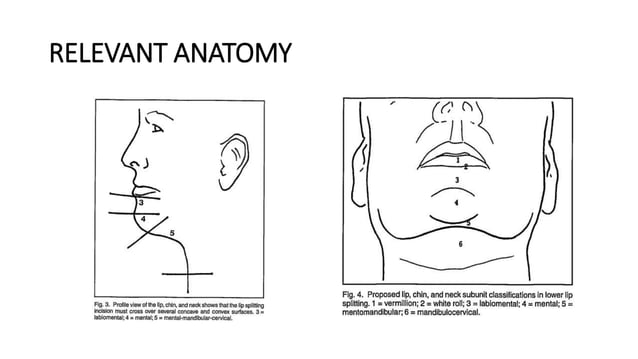 Lip splitting incisions