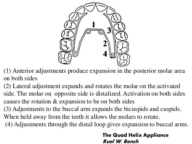 Quad helix seminar