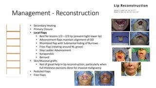 Lip Cancer 101 | PPTX