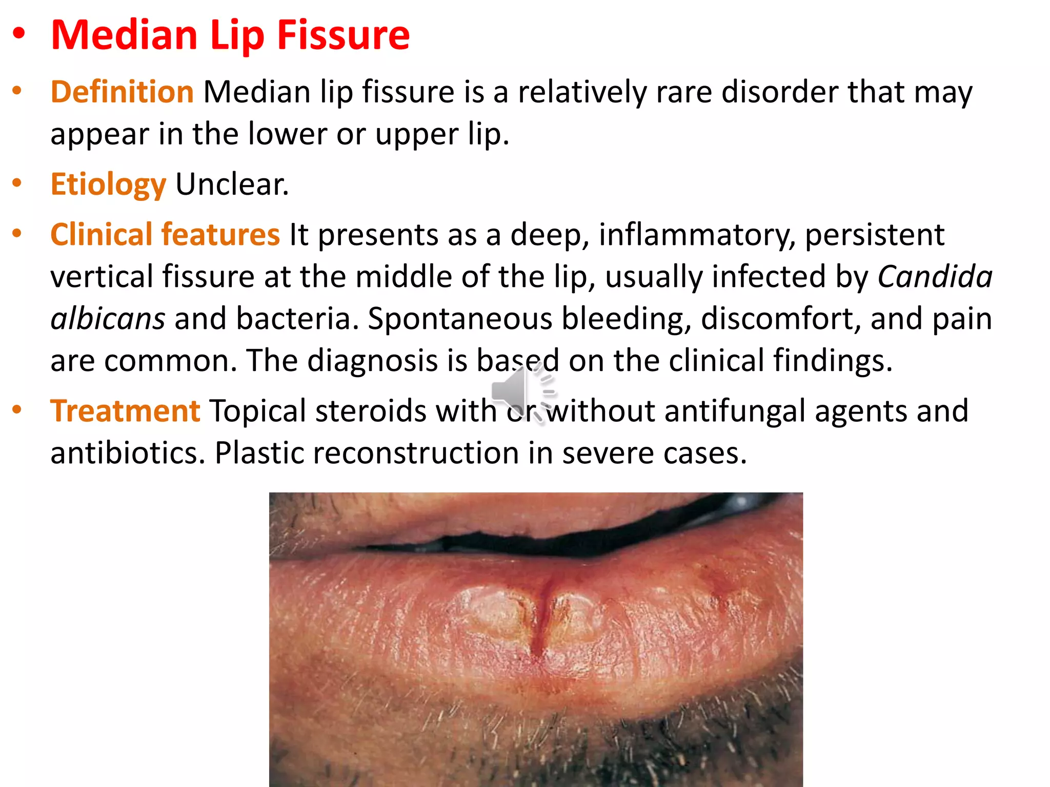 Lip diseases.pdf