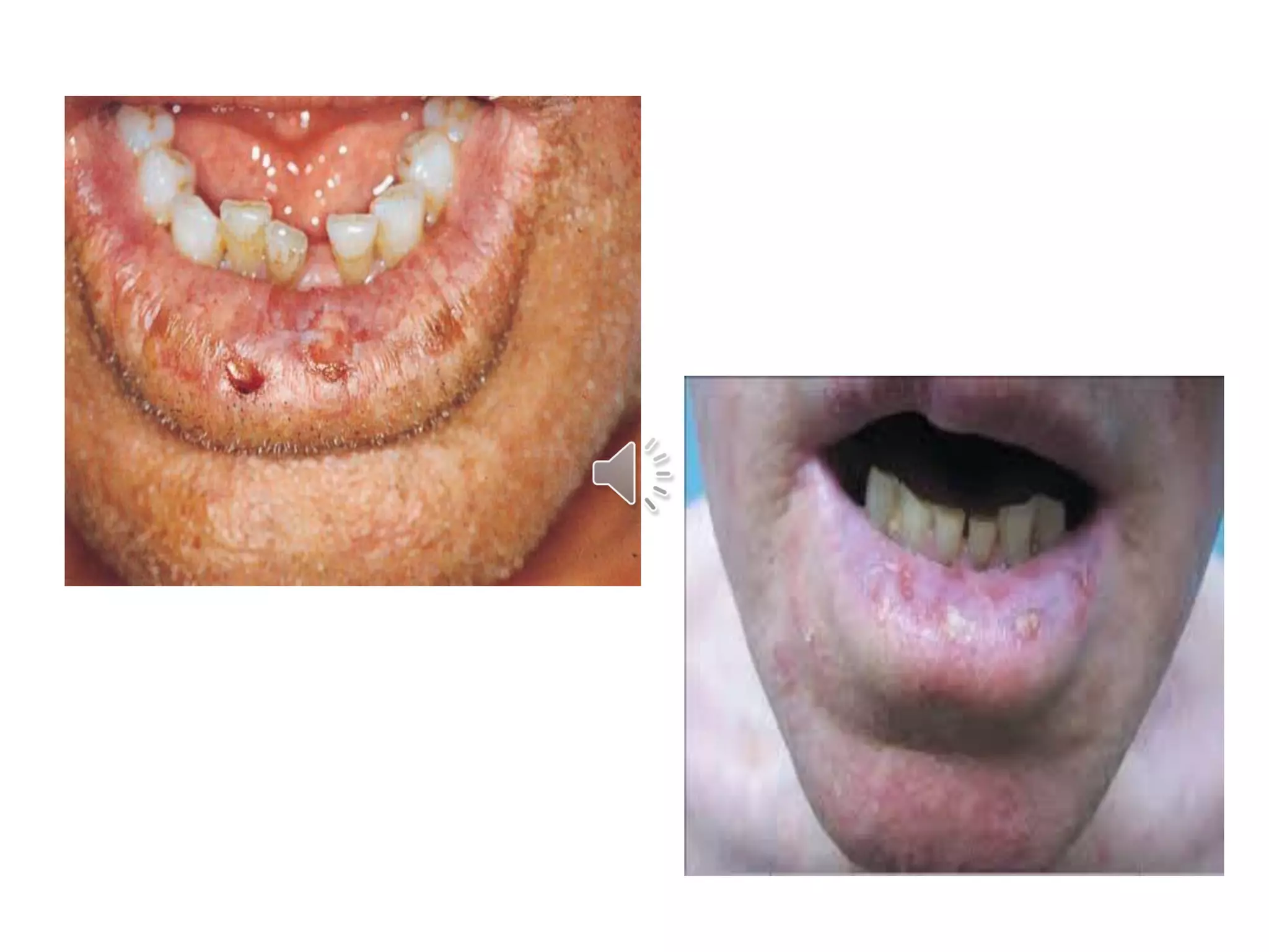 Lip diseases.pdf