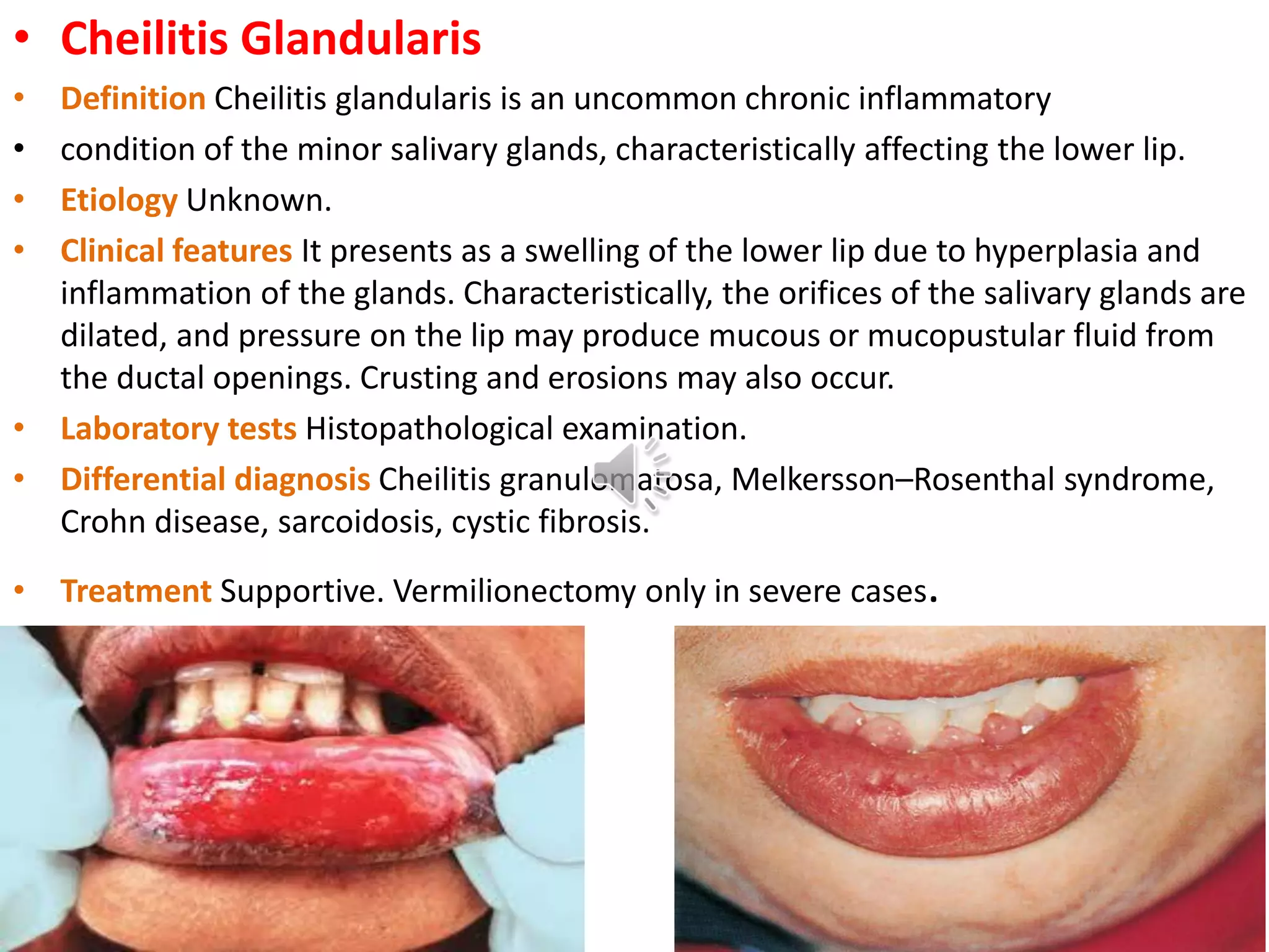 Lip diseases.pdf