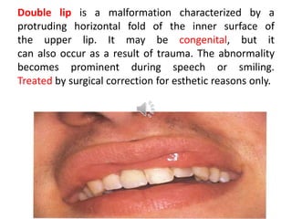Lip diseases.pdf
