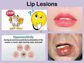 Lip diseases.pdf