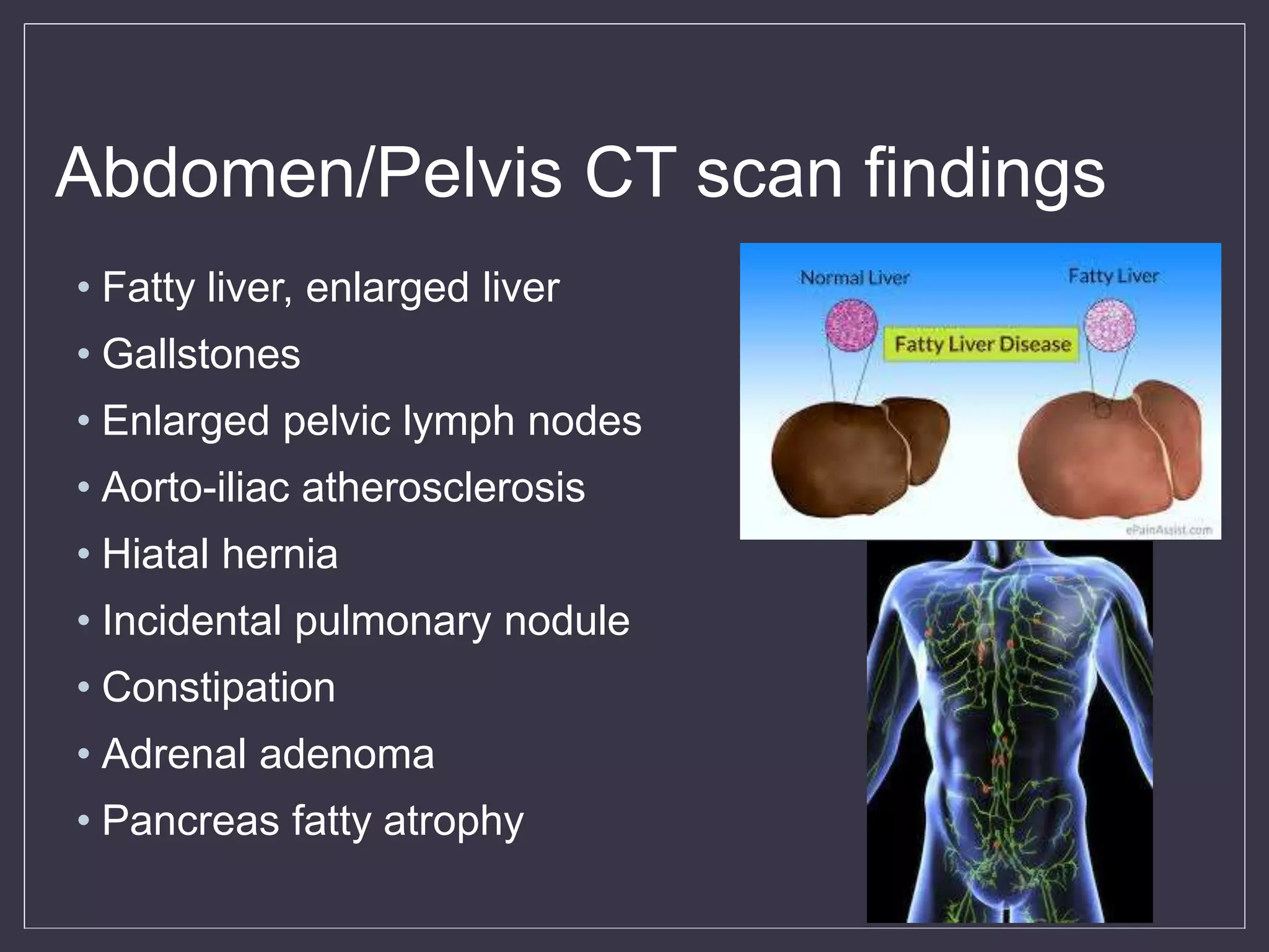 Lipedema: fatty tissue deposition syndrome | PPTX