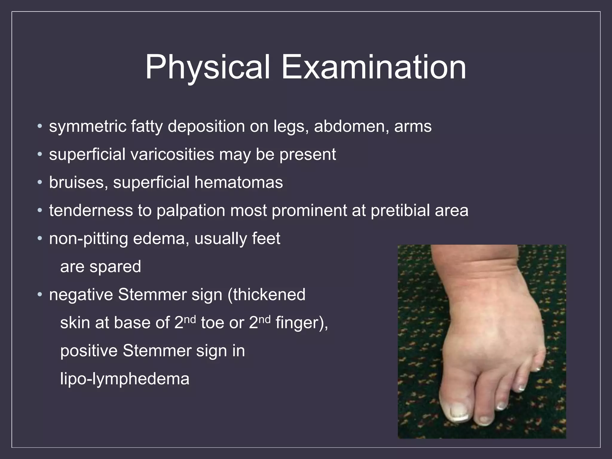 Lipedema: fatty tissue deposition syndrome | PPTX
