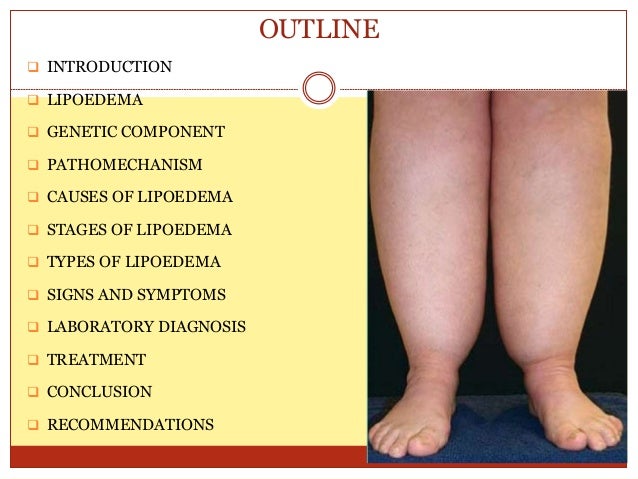 LIPOEDEMA: CLINICAL MANIFESTATTIONS, DIAGNOSIS AND TREATMENT.