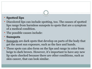 Lip Hyperpigmentation.pptx defines anatomy causes | PPT