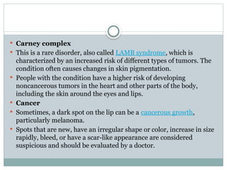 Lip Hyperpigmentation.pptx defines anatomy causes | PPT