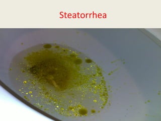 Lipid Digestion Muhammad Mustansar FJMC LAHORE | PPT