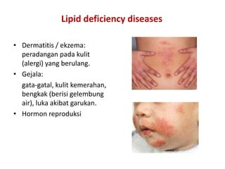 LIPID.ppt