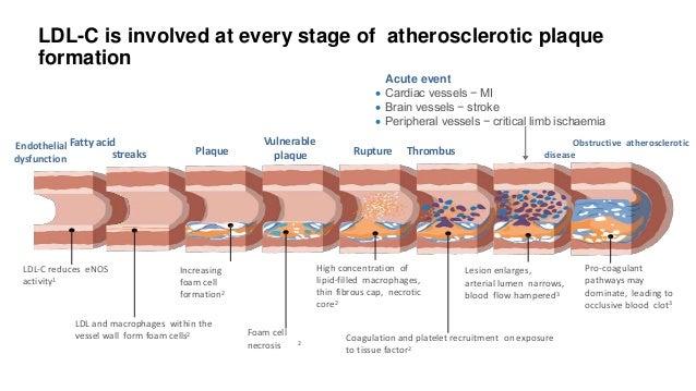 LDL Cholesterol Target :“ Lower the Better