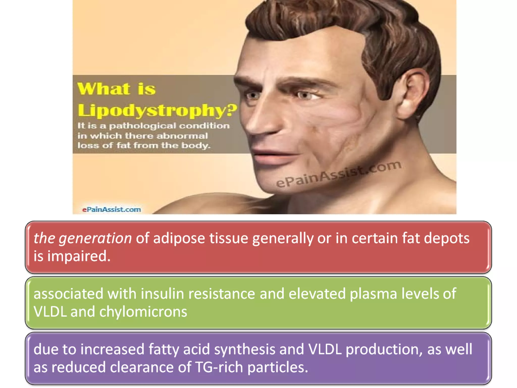 Lipid disorders | PPT