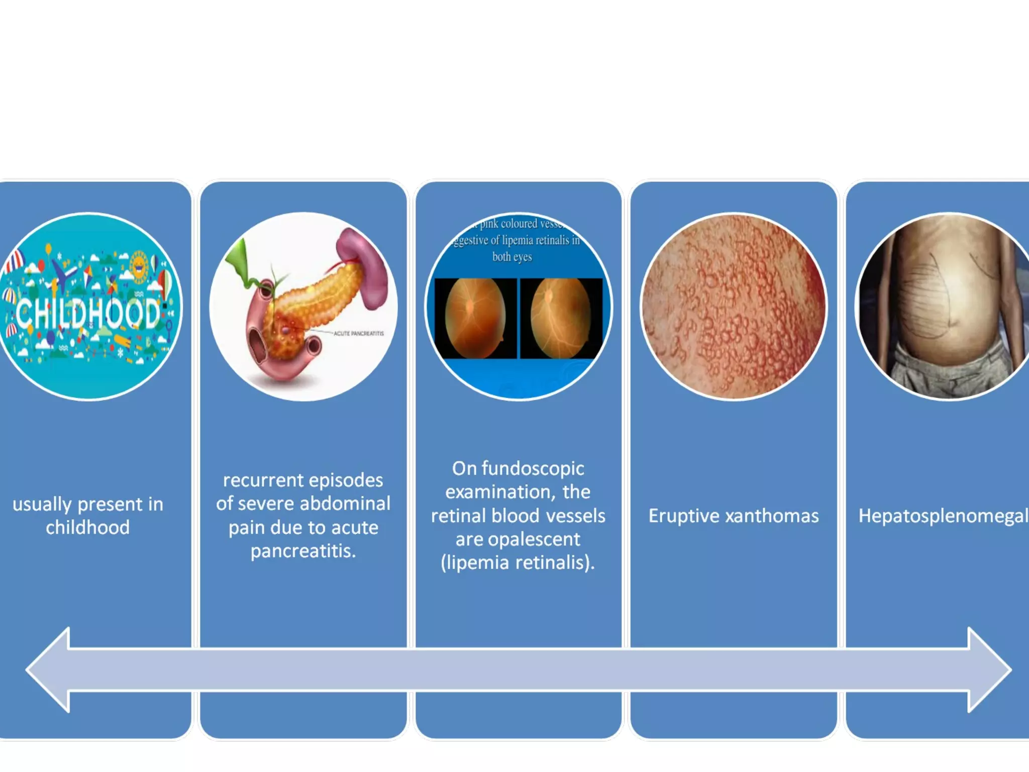 Lipid disorders | PPT