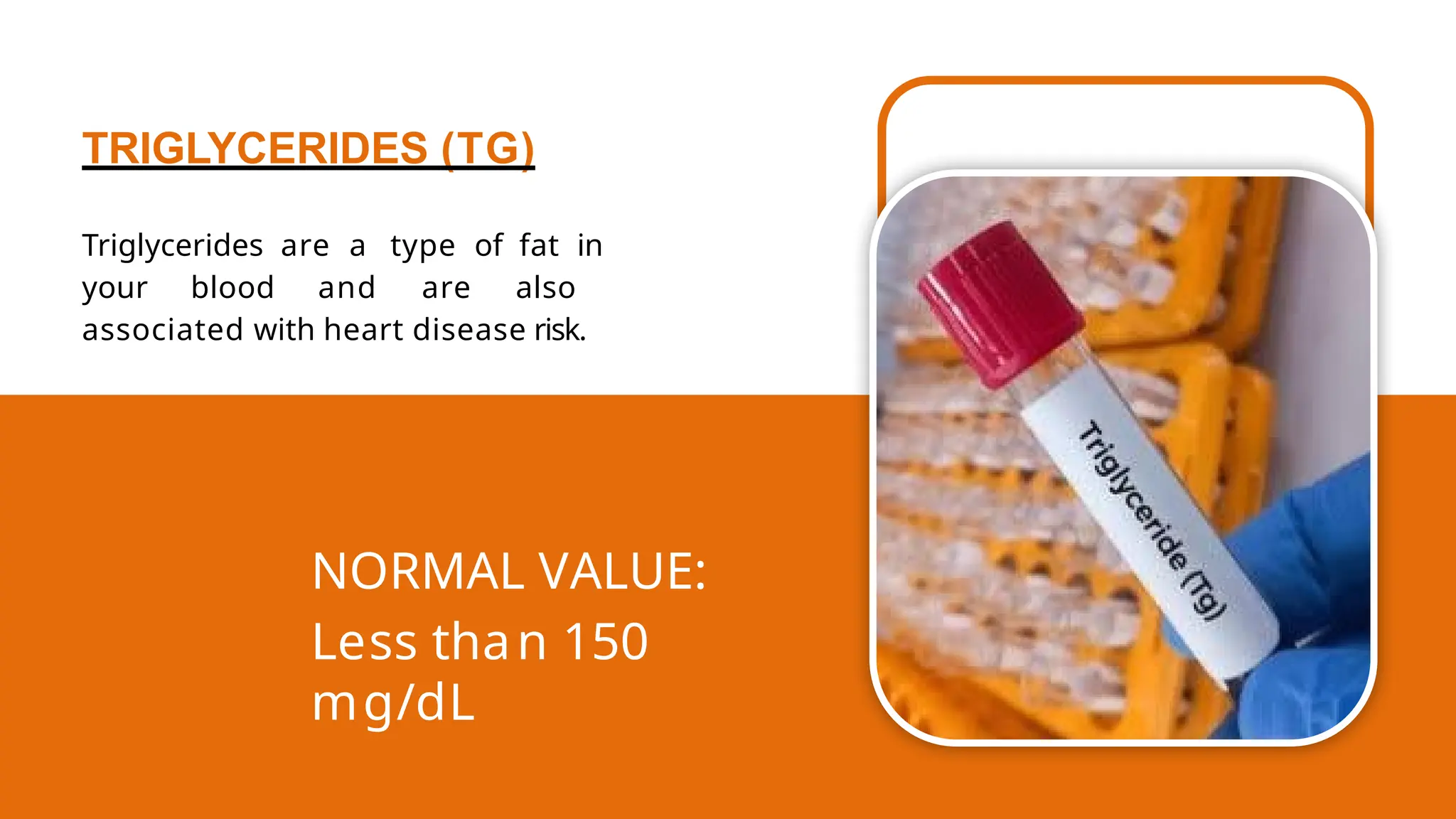 "Lipid Profile: Comprehensive Blood Test for Cholesterol, HDL, LDL ...