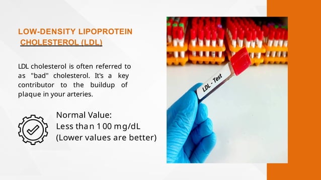 "Lipid Profile: Comprehensive Blood Test for Cholesterol, HDL, LDL ...