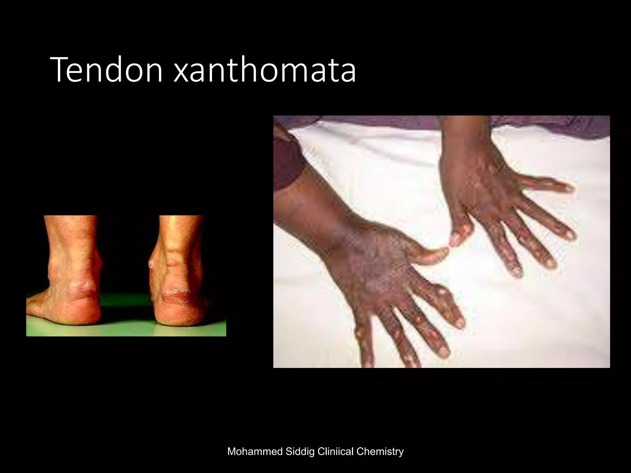 Lipids-Lipoproteins-2.ppt