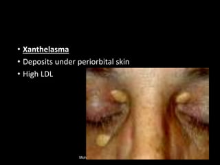 Lipids-Lipoproteins-2.ppt