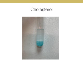 Biochemistry 1- lipids experiment presentation | PDF