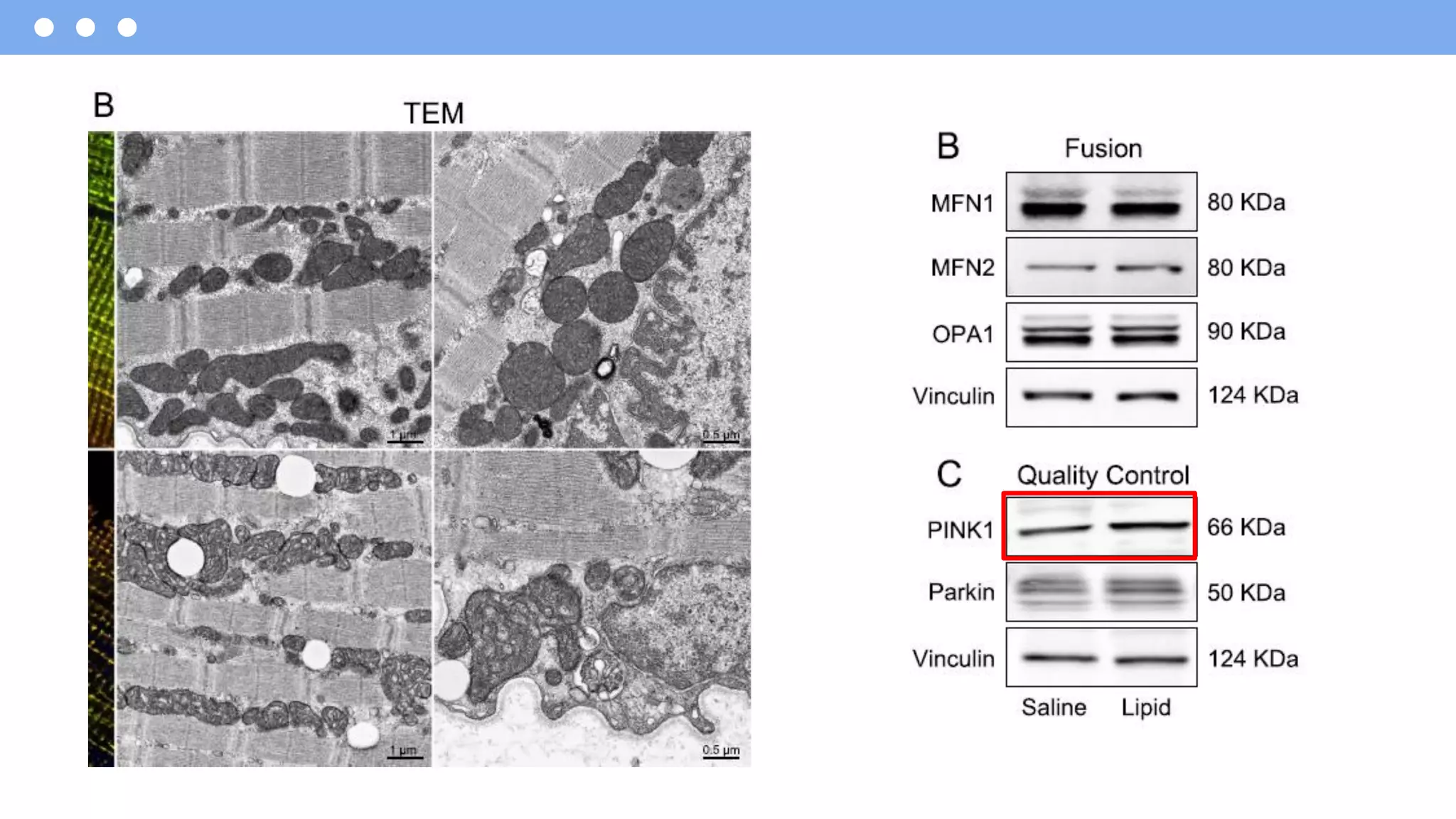 Lipids activate skeletal muscle mitochondrial fission and quality ...