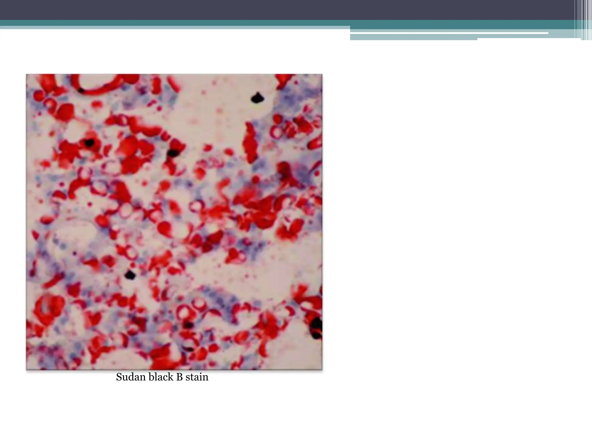 Lipid staining new slideshare which help | PPTX