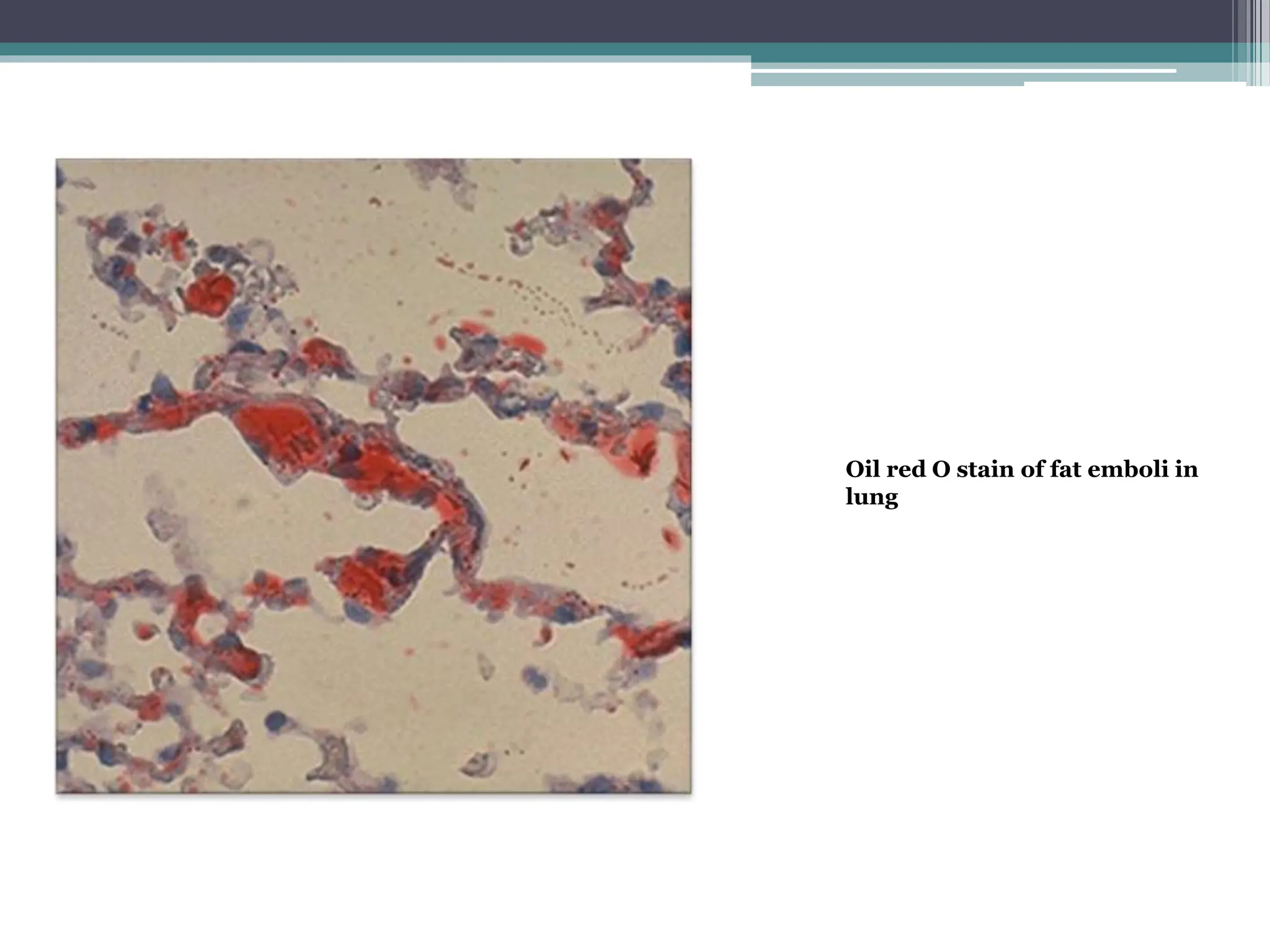 Lipid staining new slideshare which help | PPTX