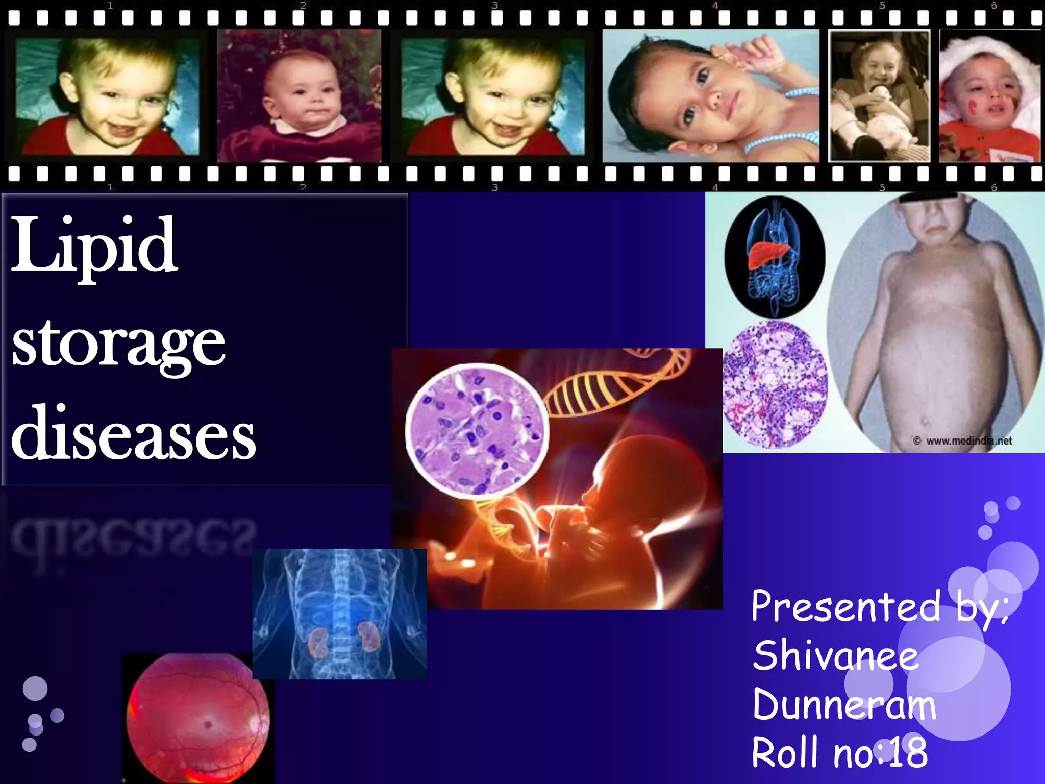 Lipid storage diseases | PPTX