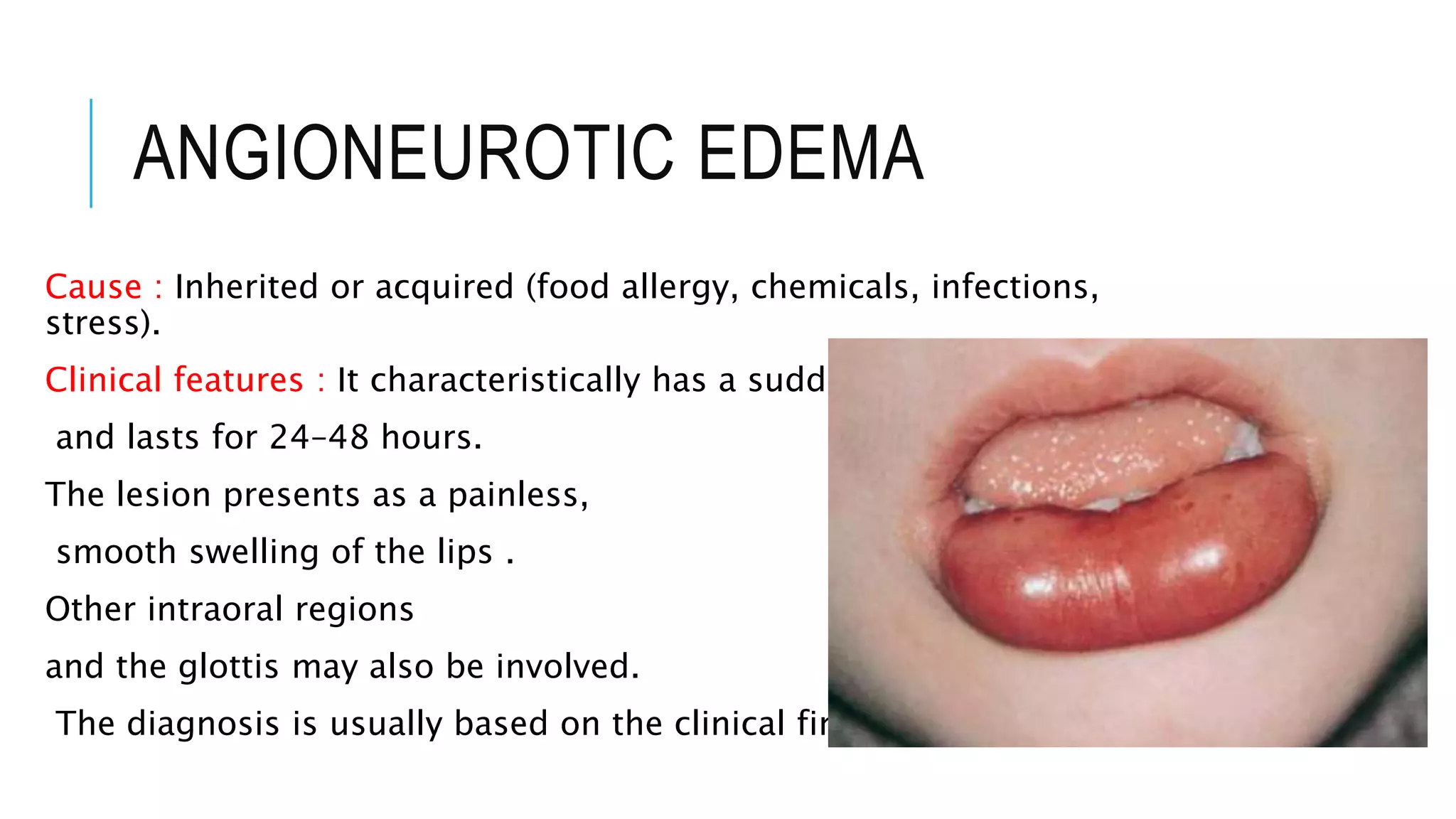 Lip lesion oral medicine | PPTX