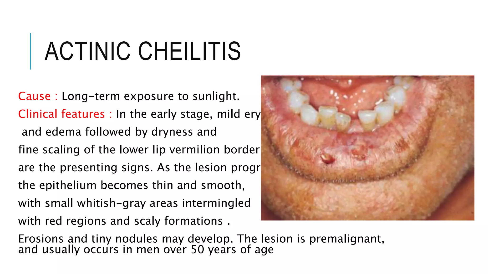 Lip lesion oral medicine | PPTX