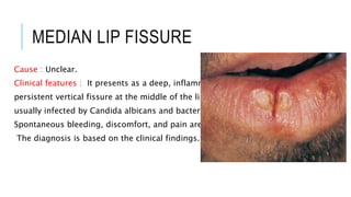 Lip lesion oral medicine | PPTX