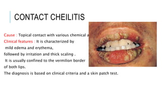 Lip lesion oral medicine | PPTX
