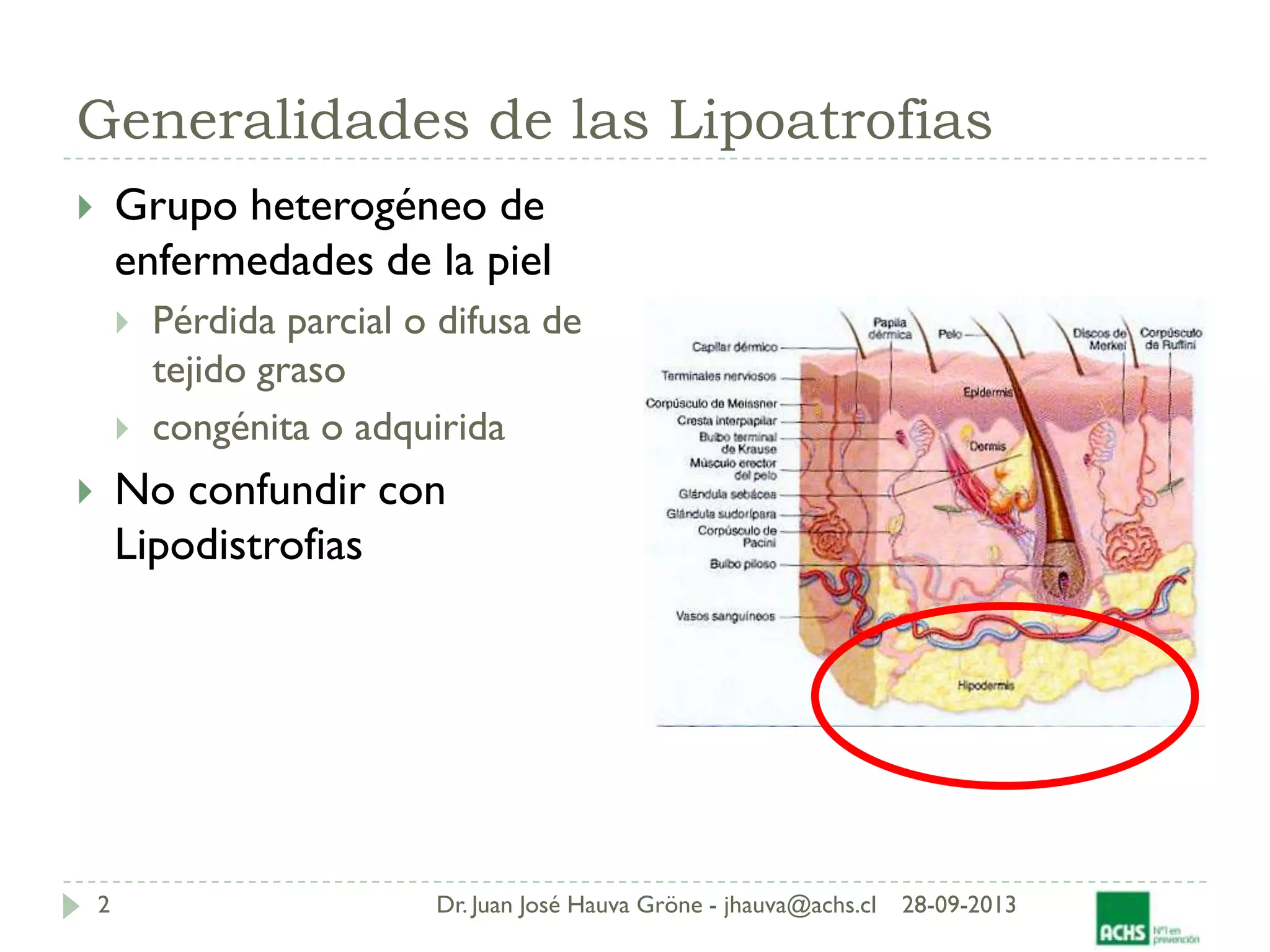Lipoatrofia semicircular, la experiencia de Coyhaique | PPTX ...