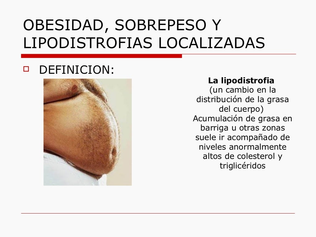 Lipodistrofia