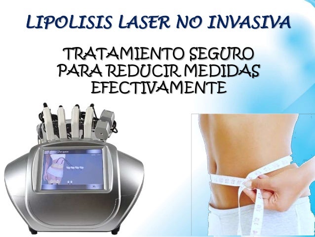 Lipolisis laser