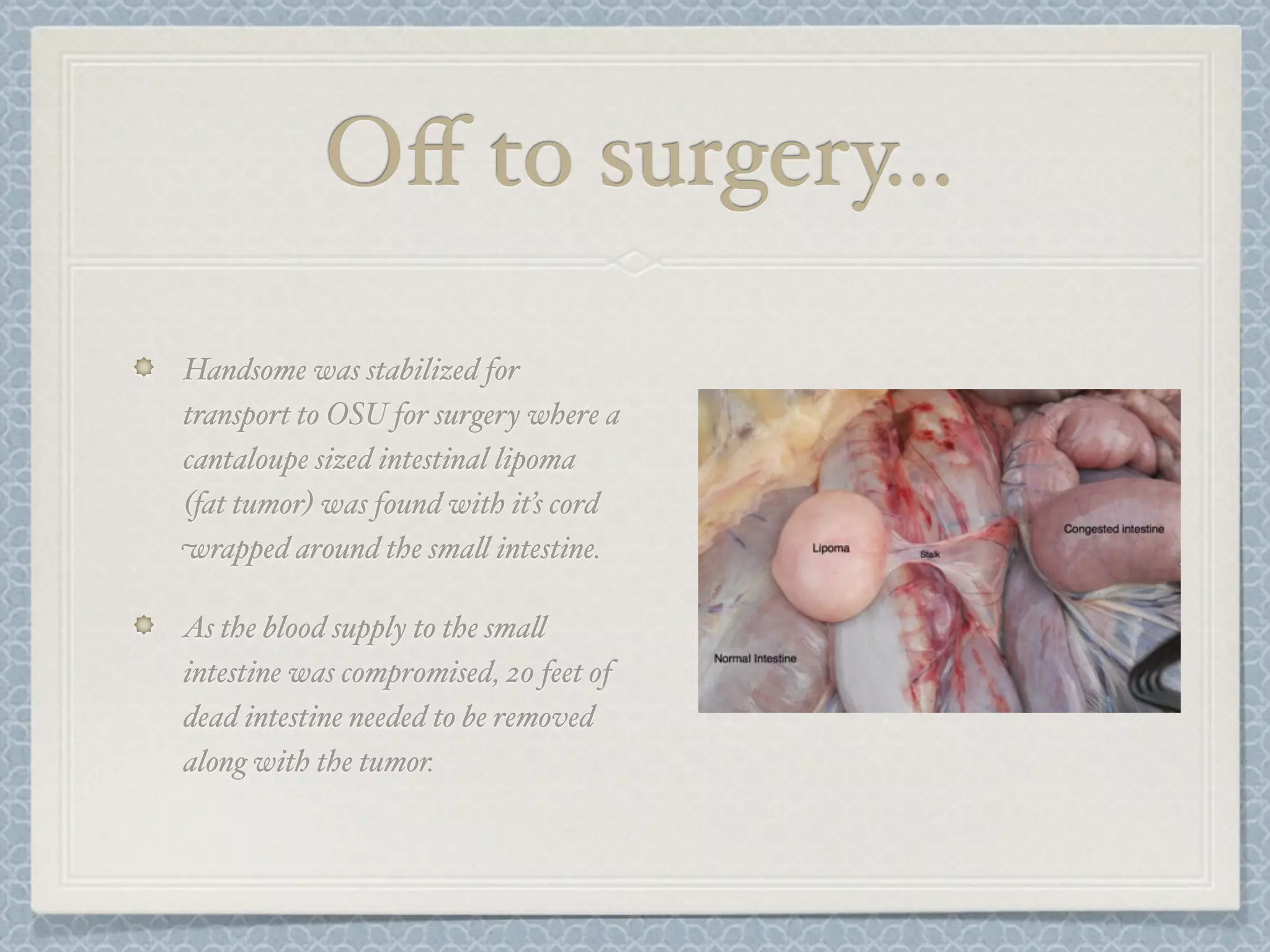 Case Study - Pedunculated Lipoma | ZIP