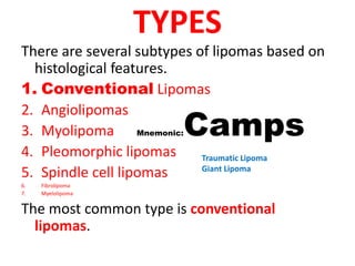 Lipoma by manzoor | PPTX